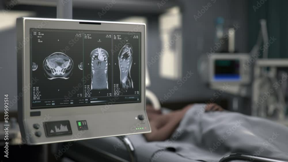 Medical equipment scanning patient organs at the clinic. Scanning the ...