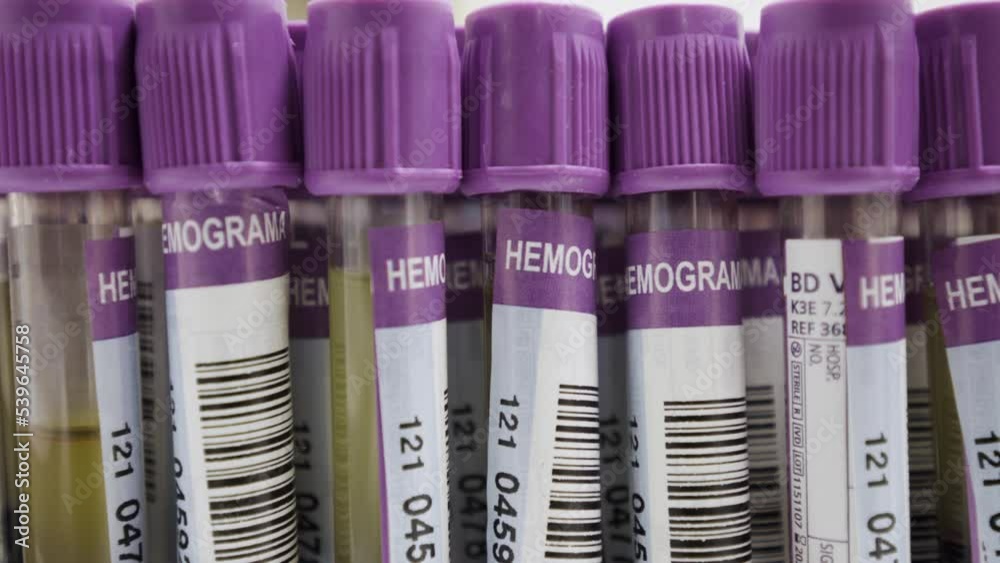 close up of urine sample sterile container pipe tubes stored all ...