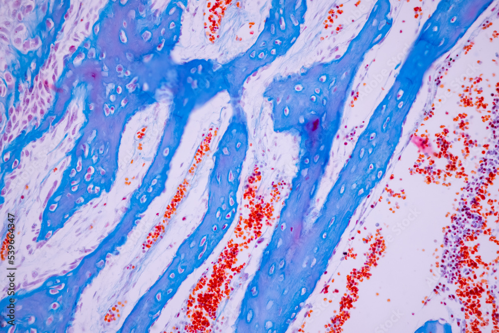 Hyaline cartilage, Elastic cartilage and Bone Human under the ...