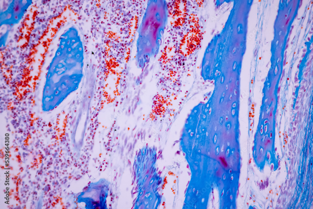 Hyaline cartilage, Elastic cartilage and Bone Human under the ...