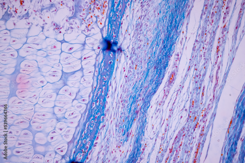 Hyaline cartilage, Elastic cartilage and Bone Human under the ...