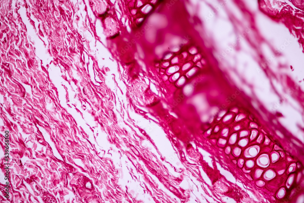 Hyaline cartilage, Elastic cartilage and Bone Human under the ...