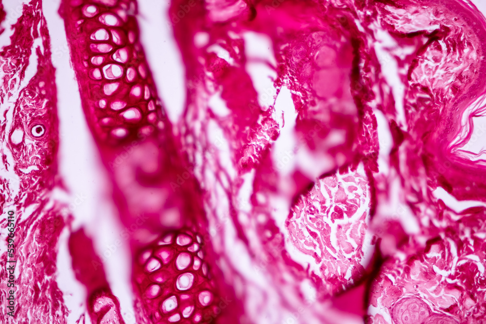 Hyaline cartilage, Elastic cartilage and Bone Human under the ...