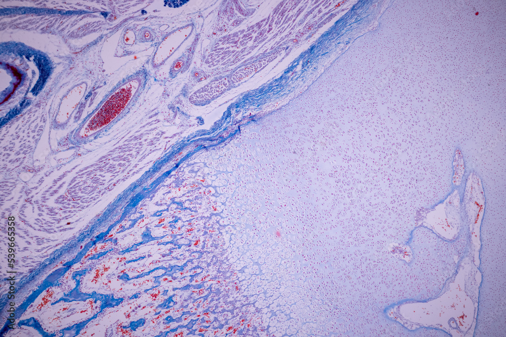 Hyaline cartilage, Elastic cartilage and Bone Human under the ...