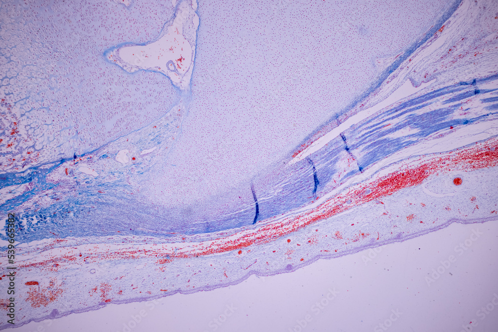 Hyaline cartilage, Elastic cartilage and Bone Human under the ...