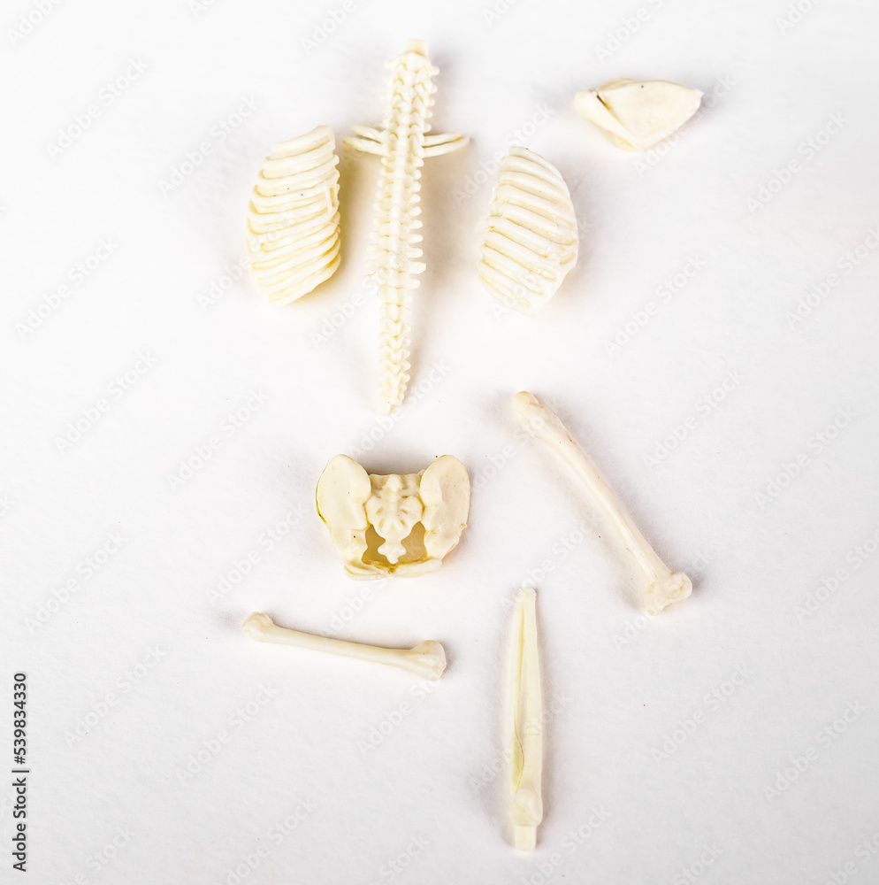 Broken bones, skeleton. Fractures, skeletal disease concept Stock Photo ...