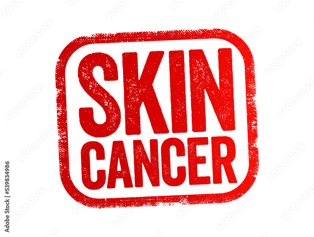 Skin Cancer text stamp concept for presentations and reports Stock ...