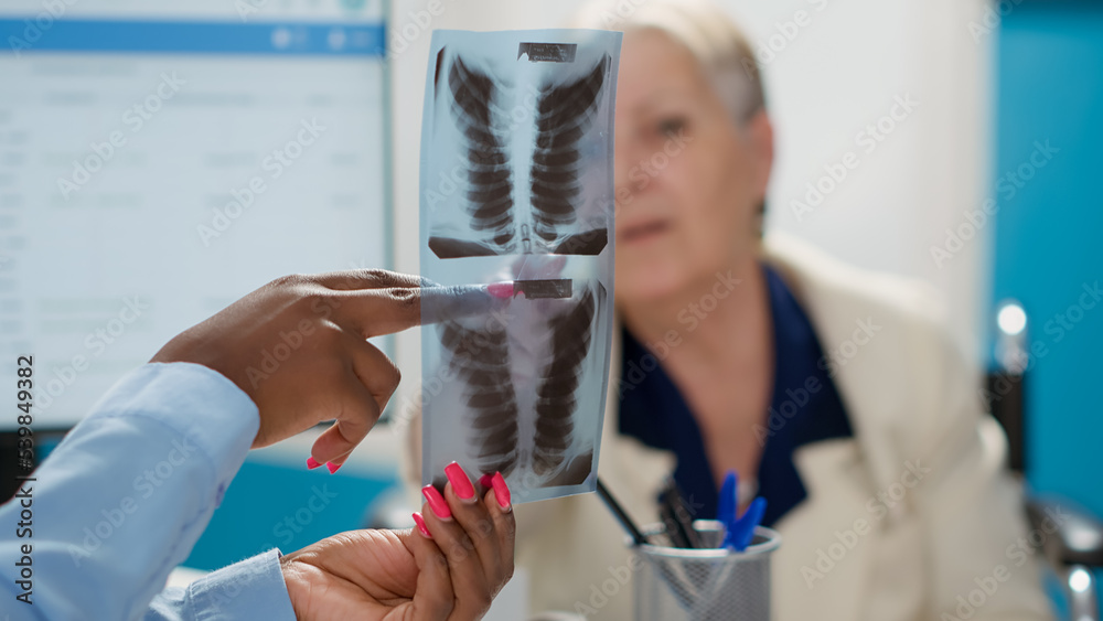 Health specialist explaining x ray scan results to elderly patient ...