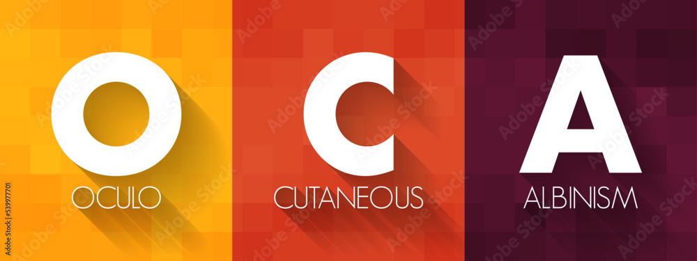 OCA Oculocutaneous Albinism - genetic disorder characterized by skin ...