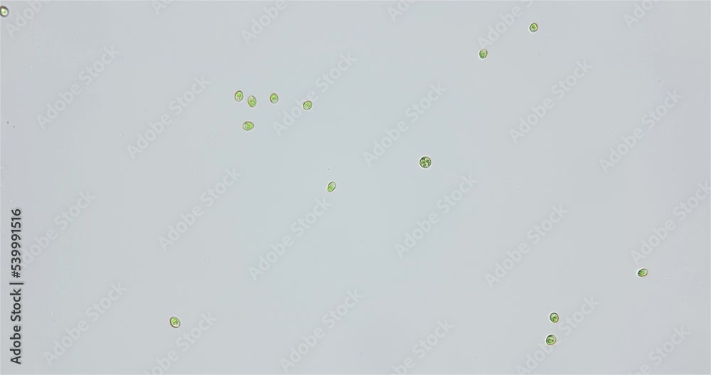 Algae Nannochloropsis under the microscope, Ochrophyta phylum ...