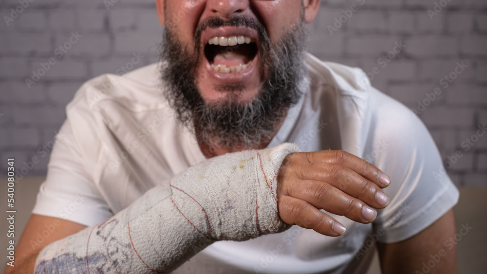 bearded man with broken arm screams in pain, distal radius fracture ...
