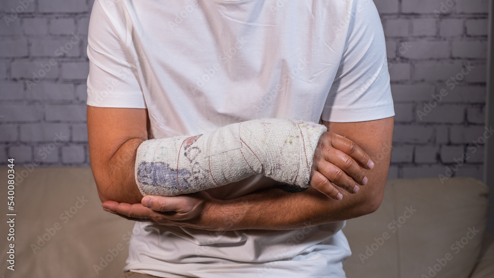 man with broken arm, distal radius fracture Stock Photo | Adobe Stock