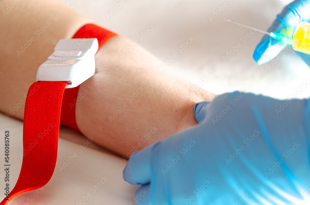 Woman's vein ready for intravenous injection during Stock Photo | Adobe ...