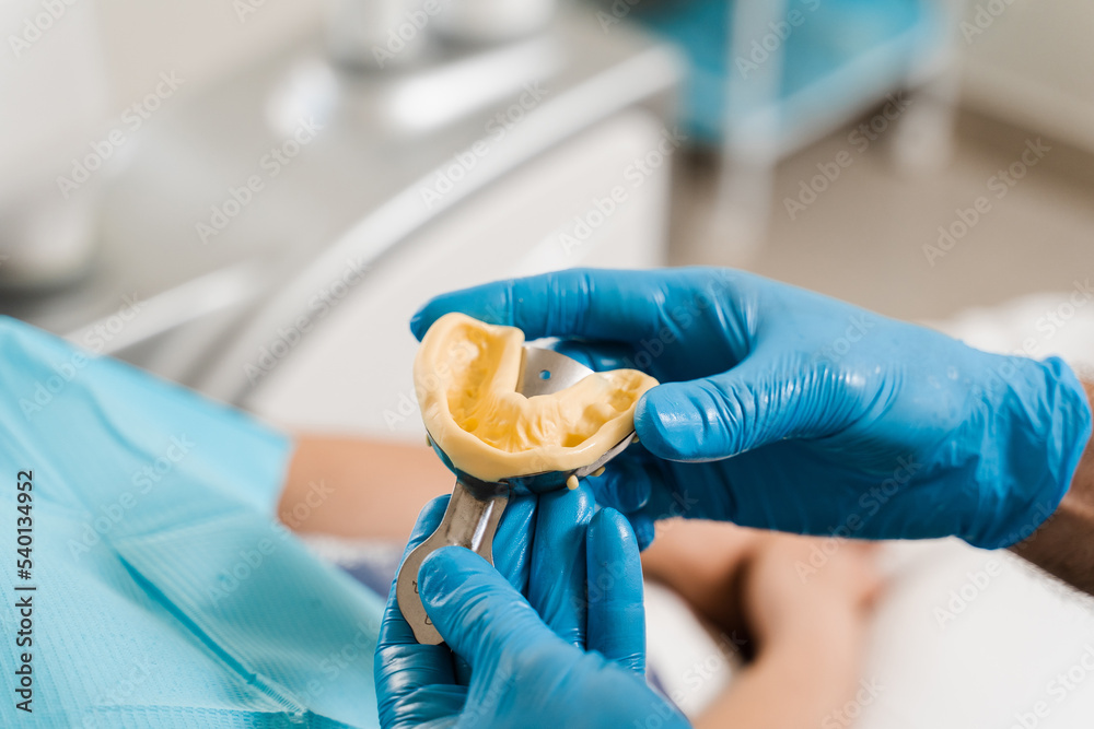 Dental cast of teeth of jaw close-up. Visiting dentist before dental ...