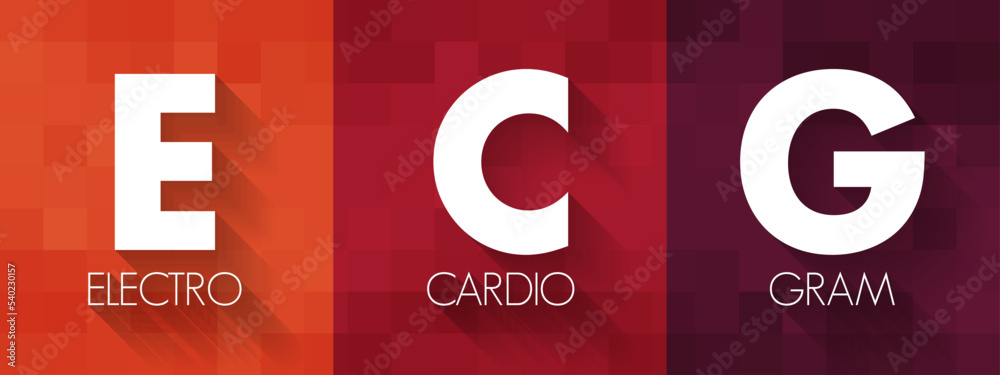 ECG Electrocardiogram - simplest and fastest tests used to evaluate the ...