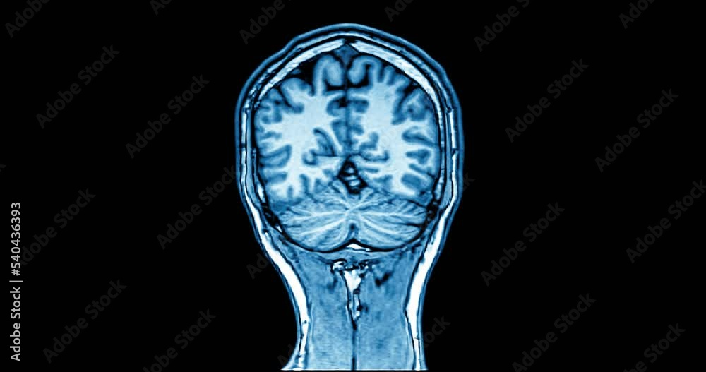 Medical scan showing human body part while scanning Stock ビデオ | Adobe Stock