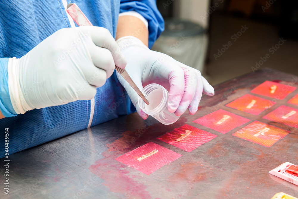 Biopsy samples being processed at the pathology laboratory to be ...