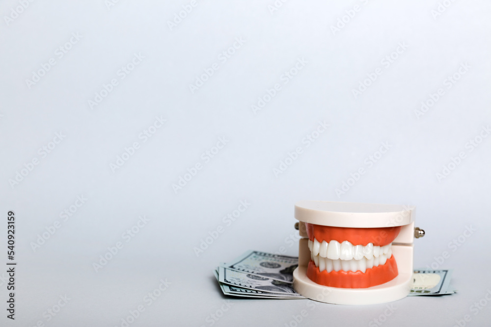 Closeup model of a human jaw with white teeth and dollar bill ...