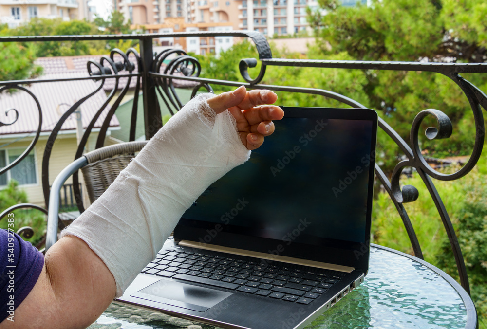 Woman hand in white plaster cast is working on a computer. A freelancer ...