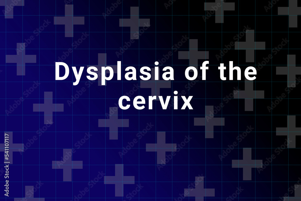 Dysplasia of the cervix disease Illustration. Dysplasia of the cervix ...