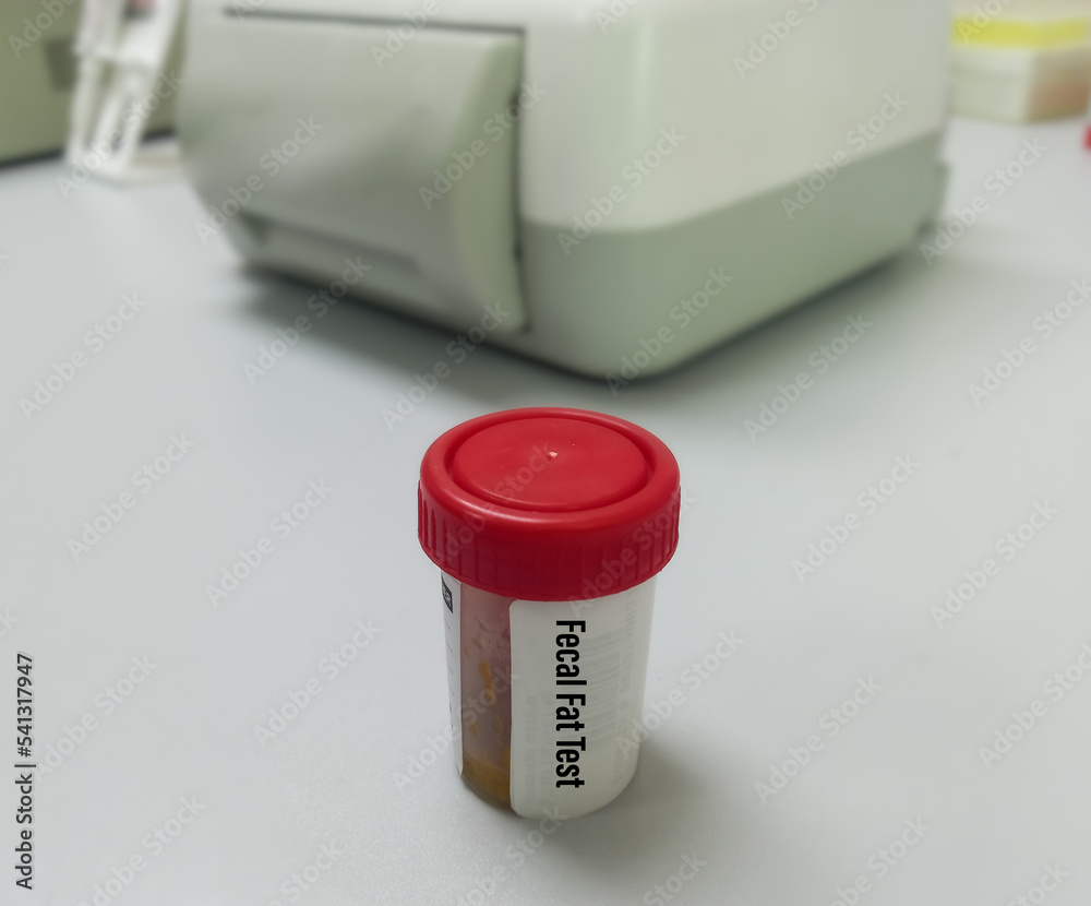 Stool sample in Plastic container for Fecal Fat test, to diagnose ...