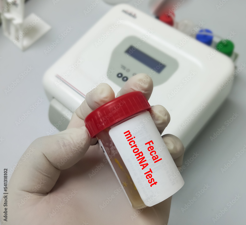 Fecal microRNA test (FmiRT). Doctor holding sample container with feces ...