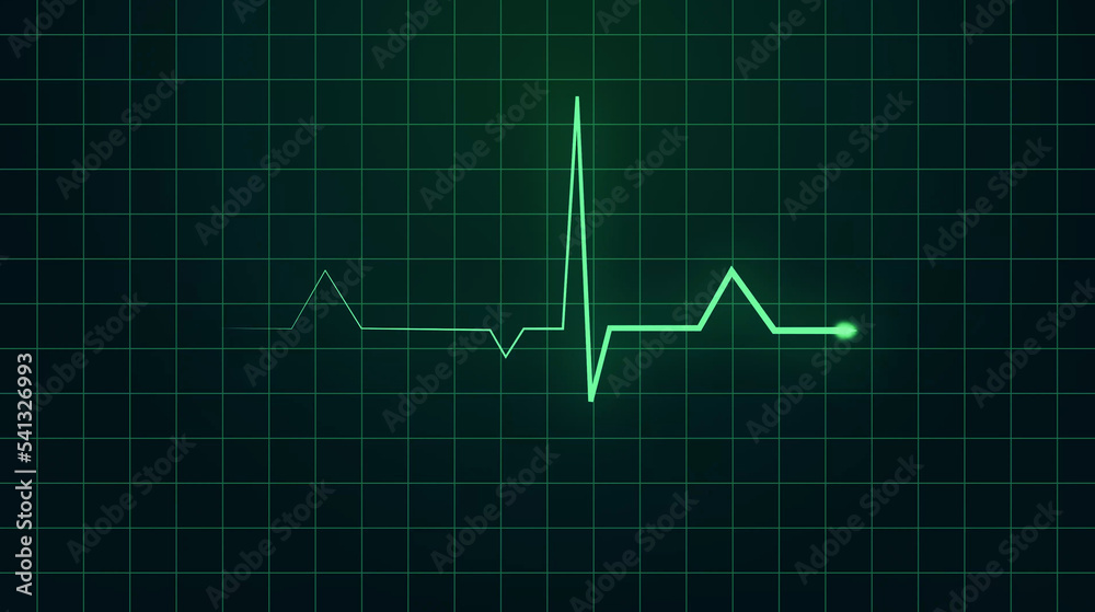Heartbeat lines illustrator background created with computer graphics ...