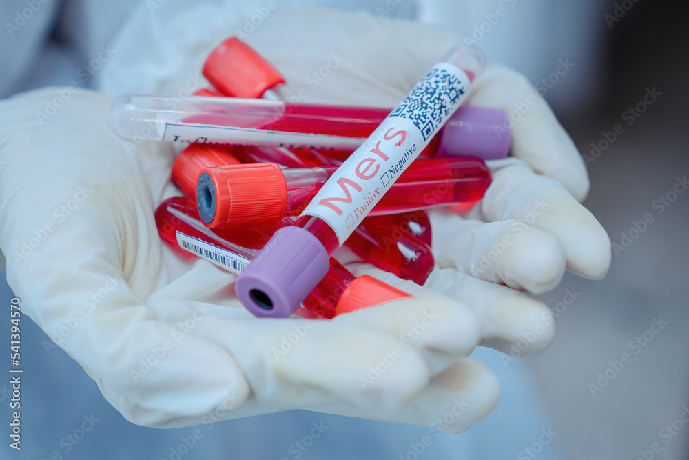 Mers PCR test tube in doctors hand, medical worker in face mask shows ...