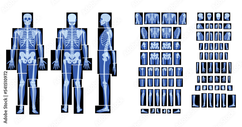 Plakat, Poster Set of X-Ray Skeleton Human body - hands, legs, chests ...