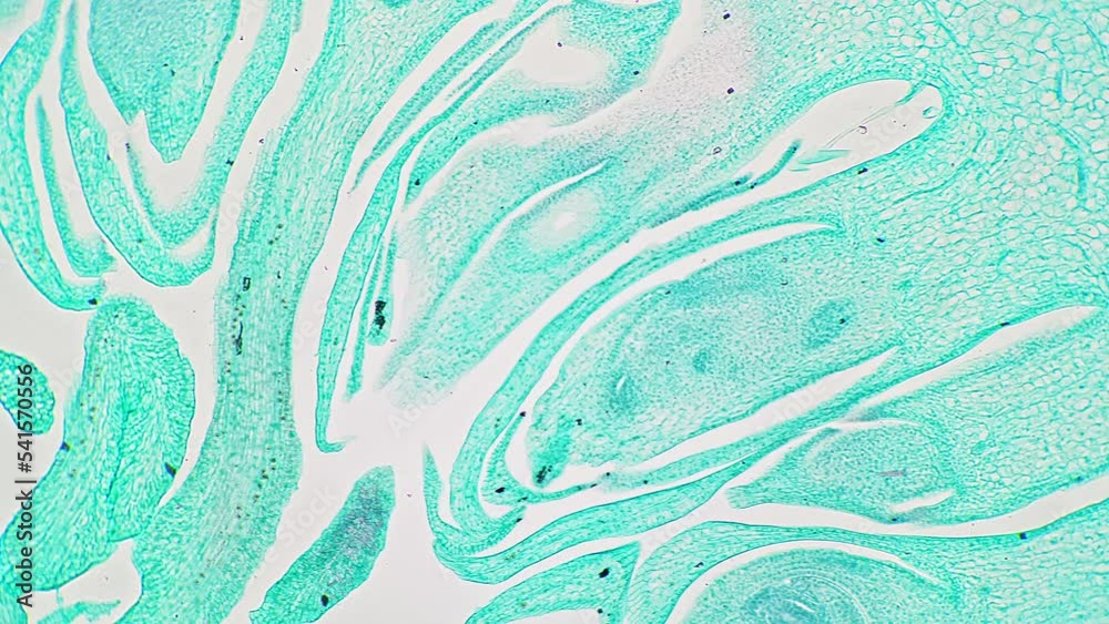 Fruit of ficus carica in transversal section magnified under microscope ...