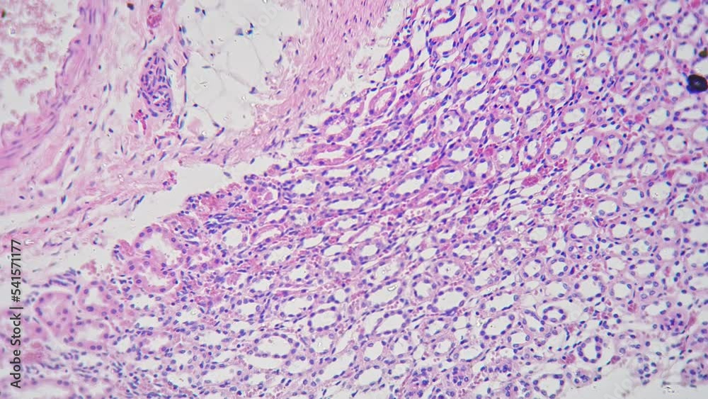Section of artery and vein under microscope with 200 times ...