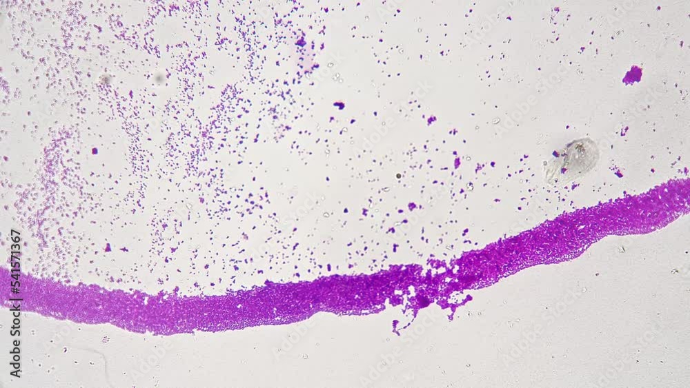 Escherichia coli smear under microscope 200x scientific slide on bright ...