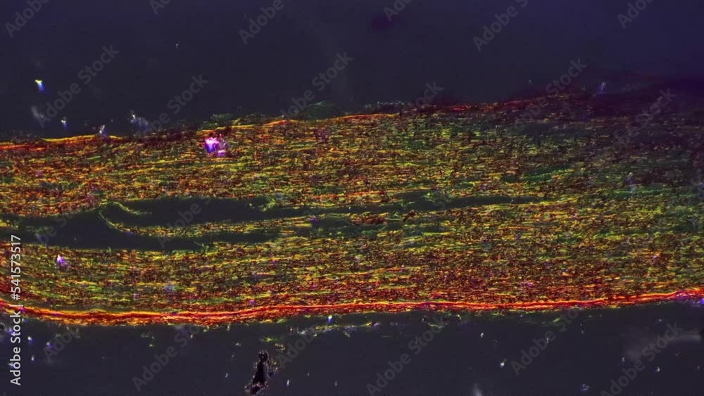 Microscopic slide of nerves trunk in longitudinal section magnified in ...