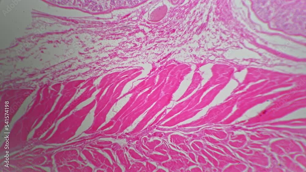 Kidney in longitudinal section under microscope with 40x magnification ...
