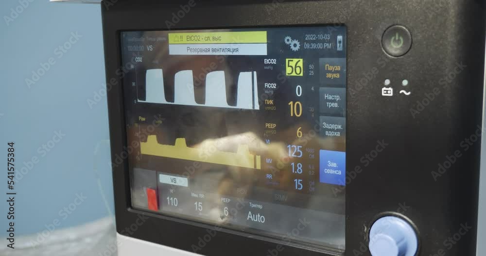 Computer monitor of the artificial lung ventilation apparatus. The ...