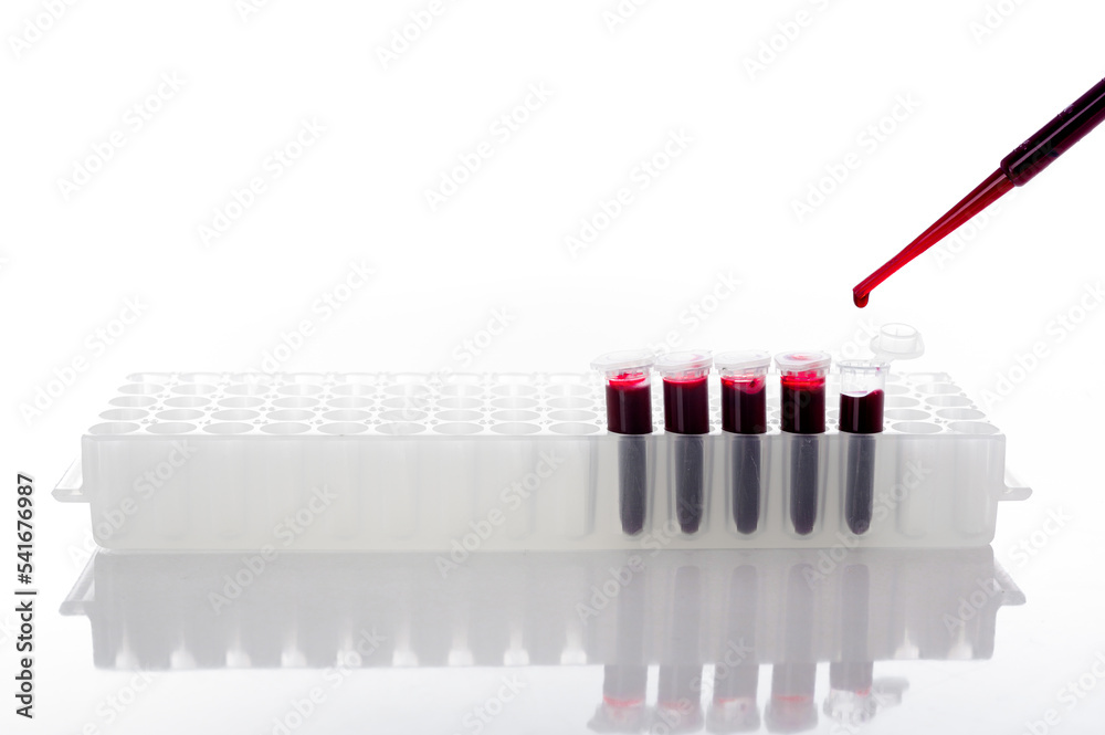 Pipette drop blood sample onto PCR tube or red liquid on PCR plate in ...