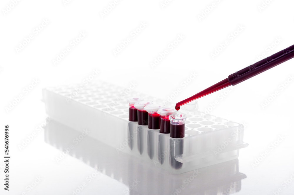 Pipette drop blood sample onto PCR tube or red liquid on PCR plate in ...