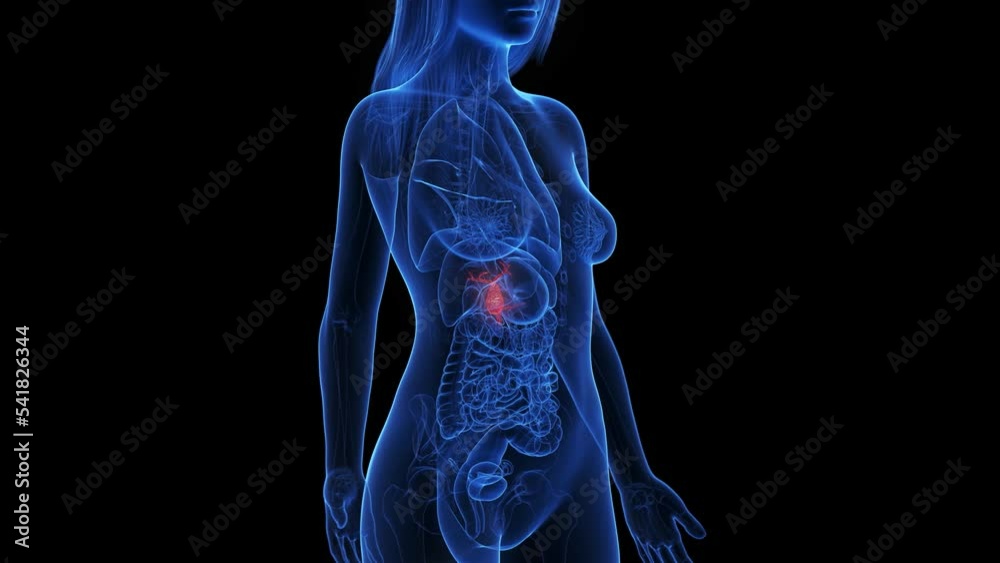 3d rendered medical animation of an inflamed gallbladder Stock Video ...