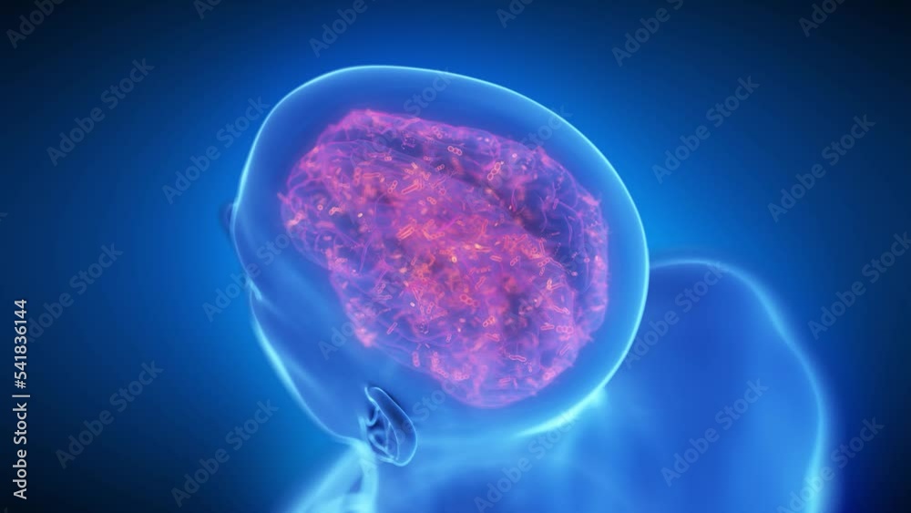 3d rendered medical animation of an infected human brain Stock Video ...