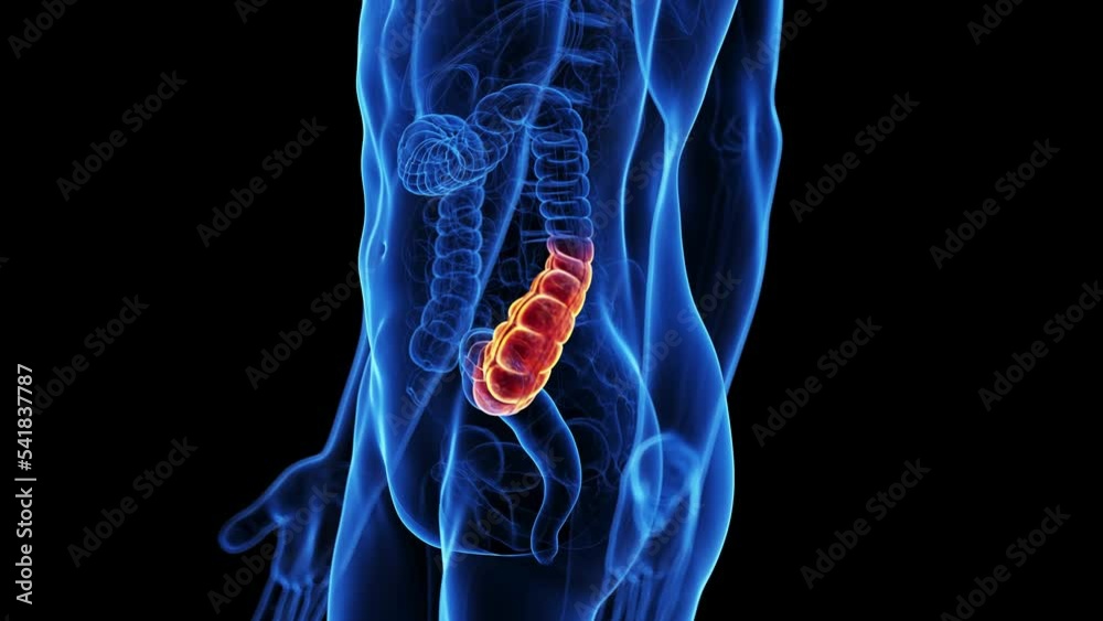 3d rendered medical animation of a constipation Stock Video | Adobe Stock