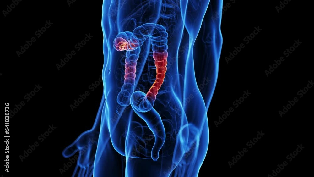 3d rendered medical animation of an irritable bowel syndrome Stock ...