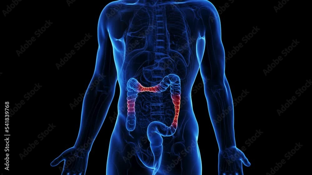 3d rendered medical animation of an irritable bowel syndrome Stock ...