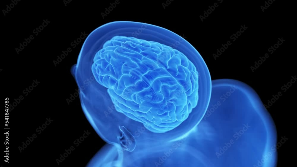 3d rendered medical animation of a degenerating brain Stock Video ...