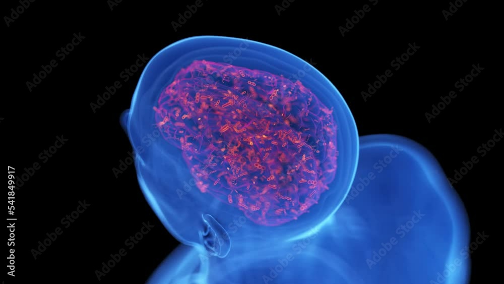 3d rendered medical animation of an infected brain Stock Video | Adobe ...