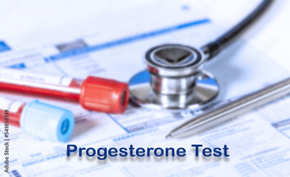 Progesterone Test Testing Medical Concept. Checkup list medical tests ...