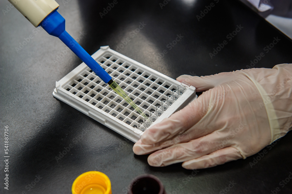 Hands with test tubes close-up. Hands in medical gloves hold tubes ...