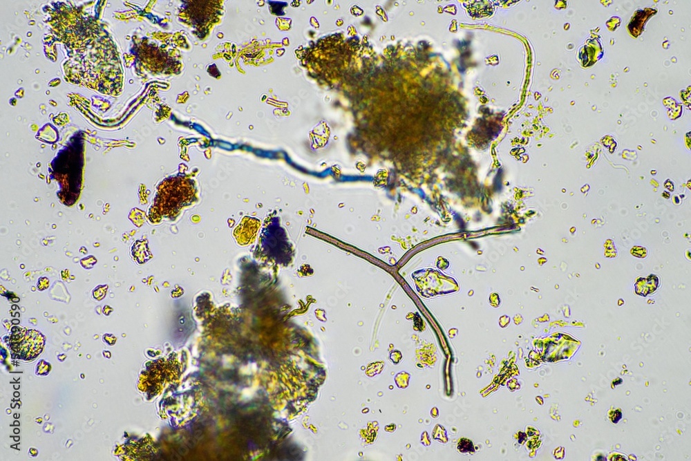soil microorganisms, with soil fungi hyphae growing in the compost in a ...