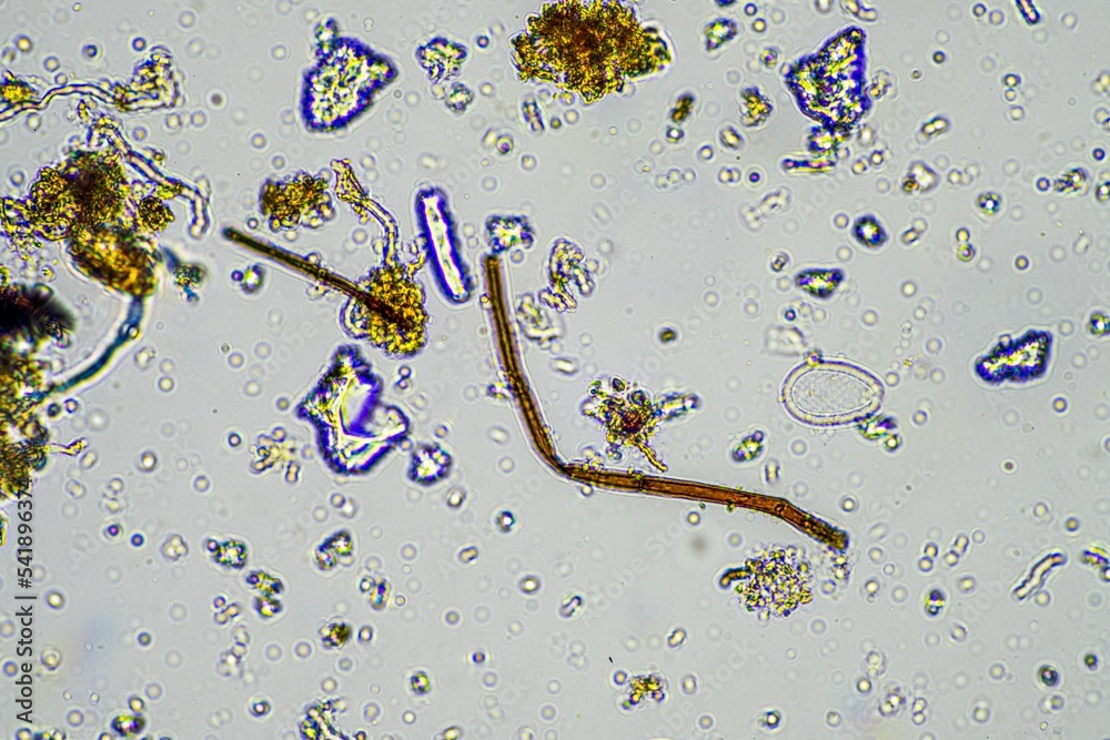 soil sample under the microscope. soil fungi and microorganisms cycling ...