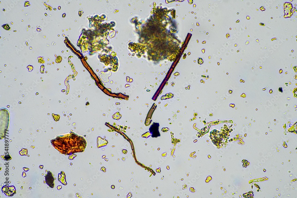 soil sample under the microscope. soil fungi and microorganisms cycling ...