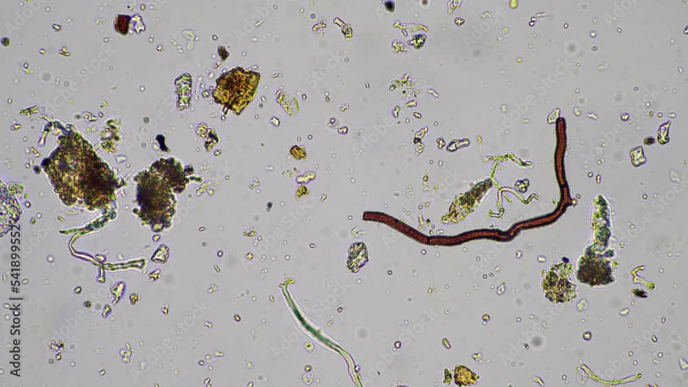Fungal and fungi hyphae under the microscope in the soil and compost ...